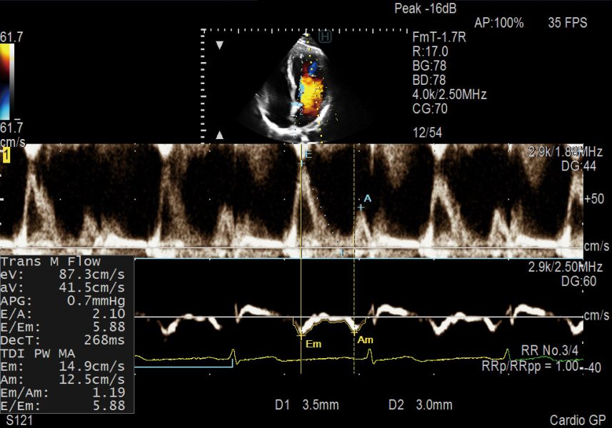 Cardiovascular Ultrasound – LISENDO 880 | Fujifilm Healthcare