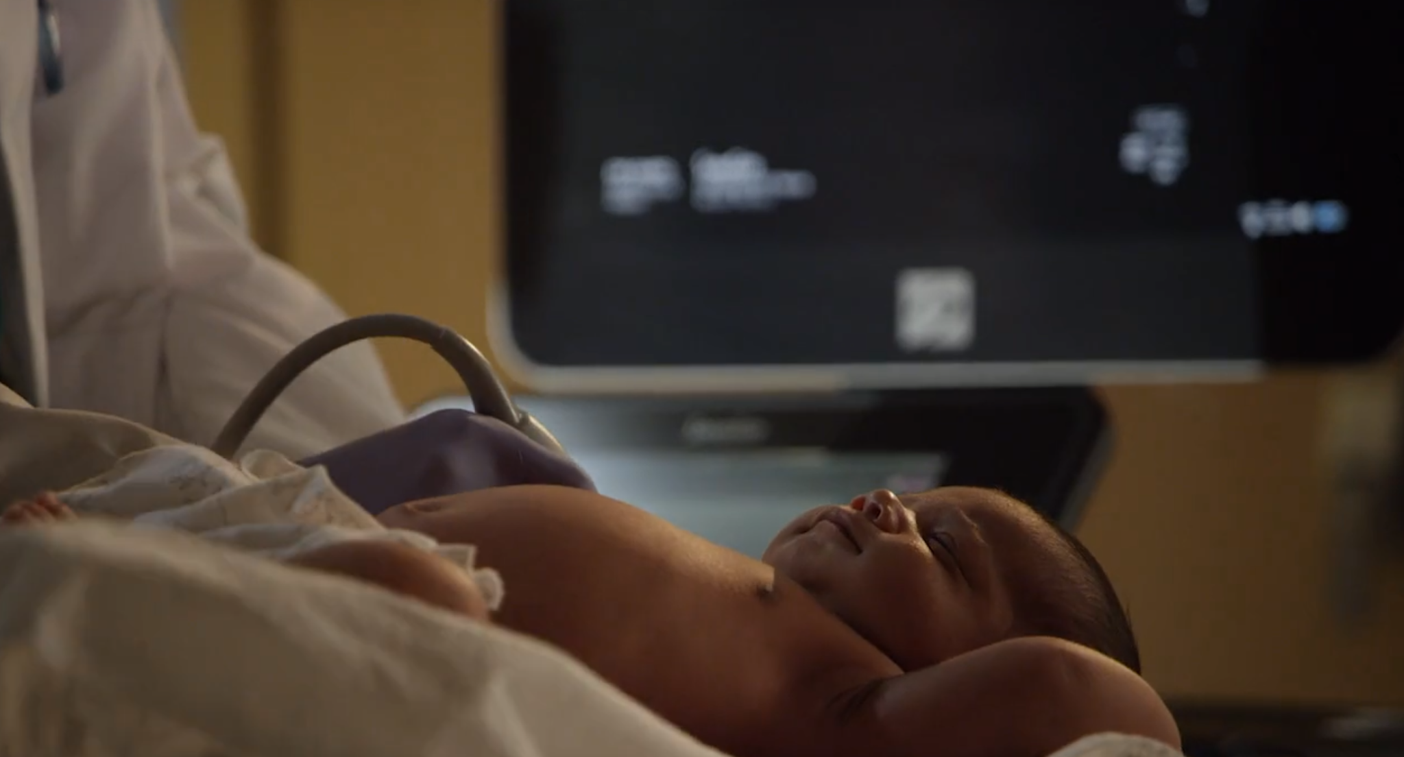 FDR Go PLUS | Fujifilm Healthcare