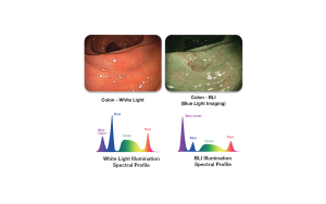 Interventional Gastro Video Imaging System | Fujifilim ELUXEO