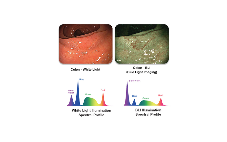 Interventional Gastro Video Imaging System | Fujifilim ELUXEO