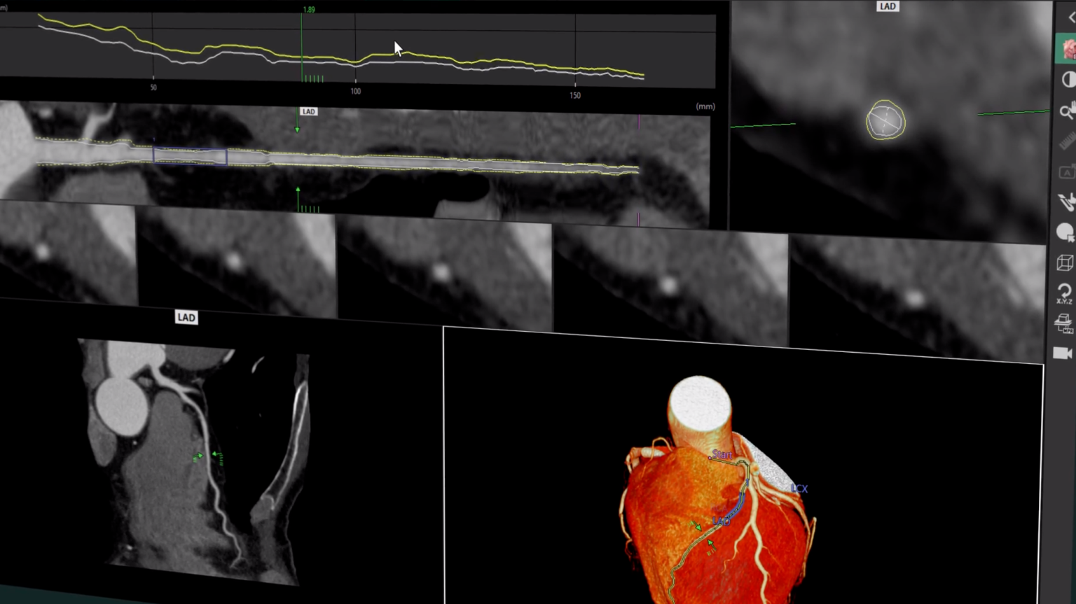 Synapse Enterprise PACS for all Departments | Fujifilm