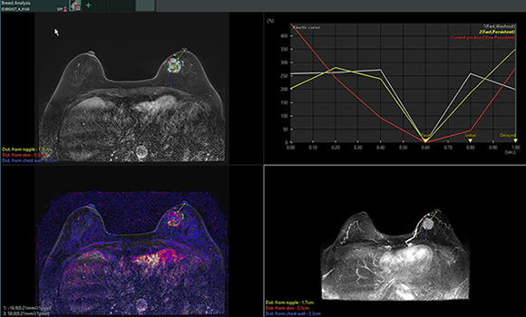 Oncology 3D Imaging Solutions | Fujifilm Synapse 3D Imaging