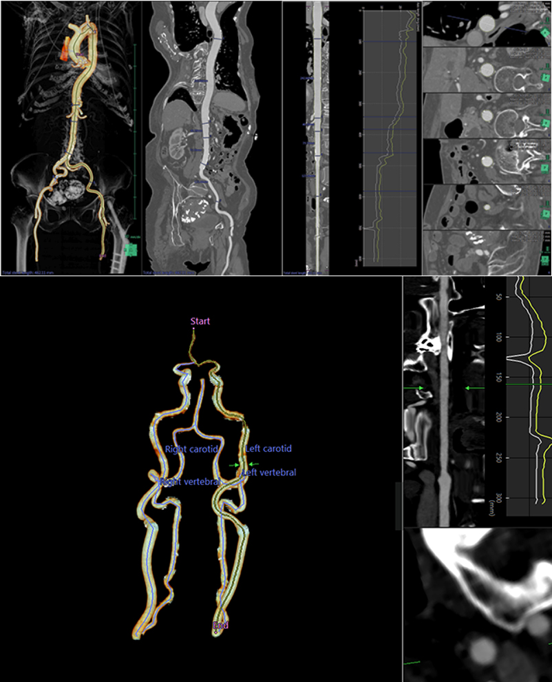 General Function | Fujifilm Healthcare