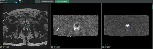 Oncology 3D Imaging Solutions | Fujifilm Synapse 3D Imaging