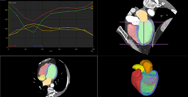 Cardiology | Fujifilm Healthcare