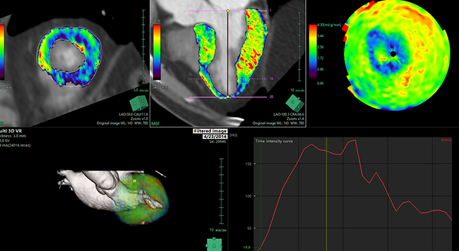 Cardiology | Fujifilm Healthcare