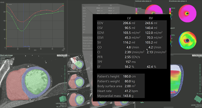 Cardiology | Fujifilm Healthcare