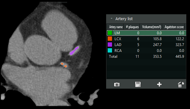 Cardiology | Fujifilm Healthcare