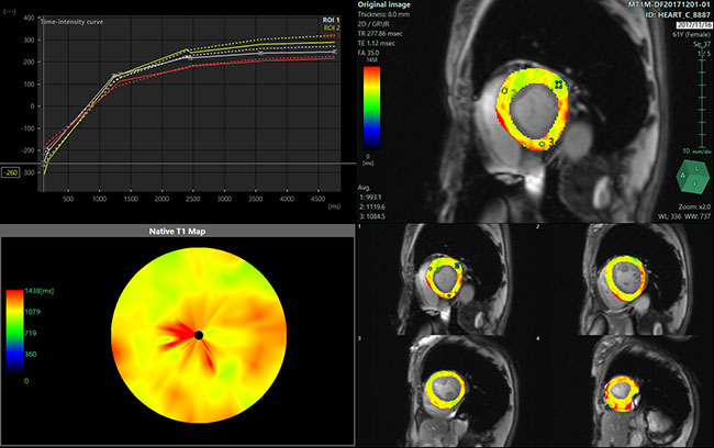 Cardiology | Fujifilm Healthcare