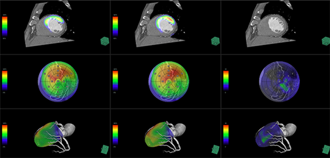 Cardiology | Fujifilm Healthcare