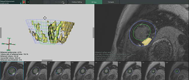 Cardiology | Fujifilm Healthcare