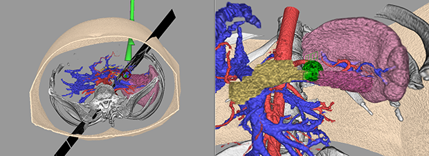 Gastroenterology | Fujifilm Healthcare