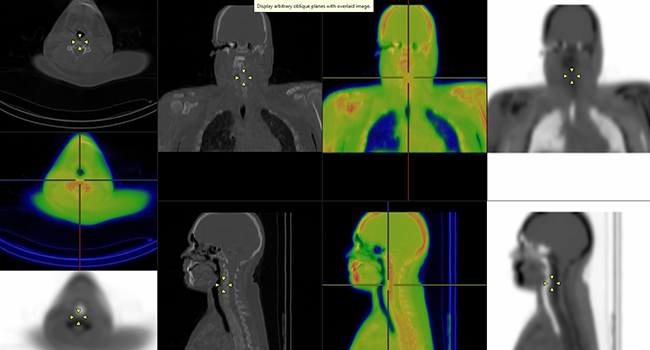 General Function | Fujifilm Healthcare