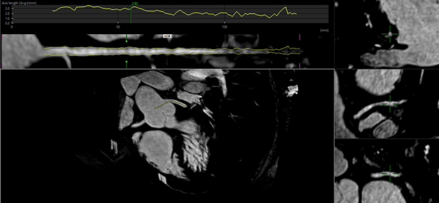 Cardiology | Fujifilm Healthcare