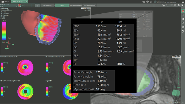 Cardiology | Fujifilm Healthcare