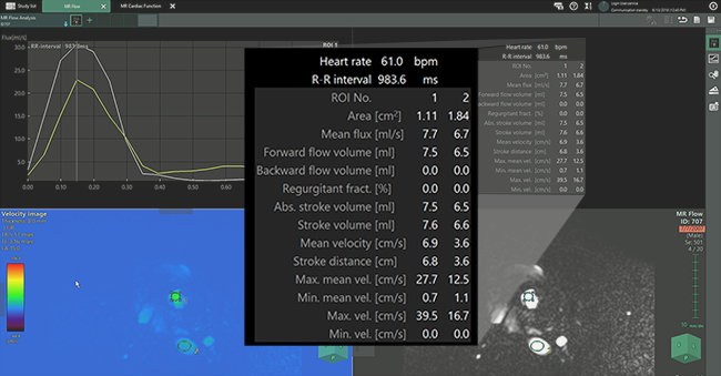 Cardiology | Fujifilm Healthcare