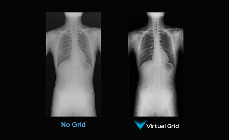 FDR Go PLUS | Fujifilm Healthcare