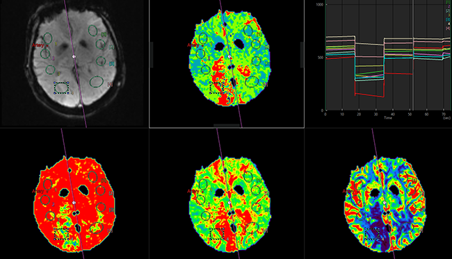 Neurology - FUJIFILM Healthcare Americas Corporation Neurology ...