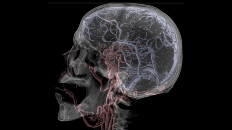 Synapse 3D Medical Imaging | Fujifilm Healthcare Solutions