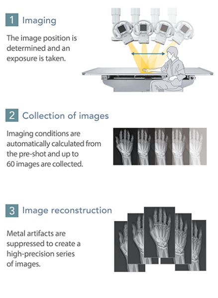 Digital Tomosynthesis | Fujifilm Healthcare