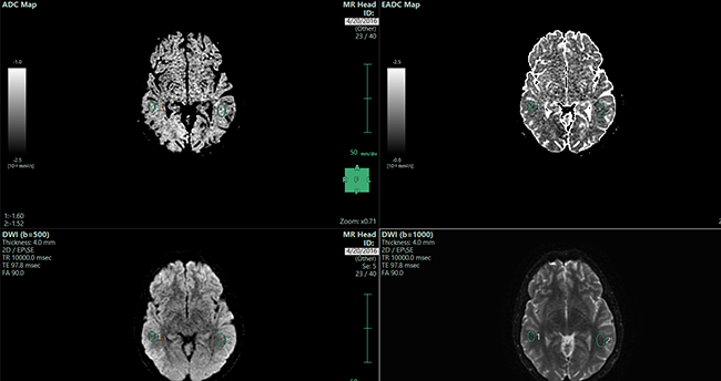 General Function | Fujifilm Healthcare