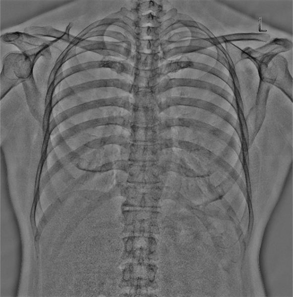 FDR Visionary Suite | Fujifilm Healthcare