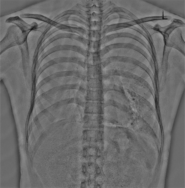 FDR Visionary Suite | Fujifilm Healthcare