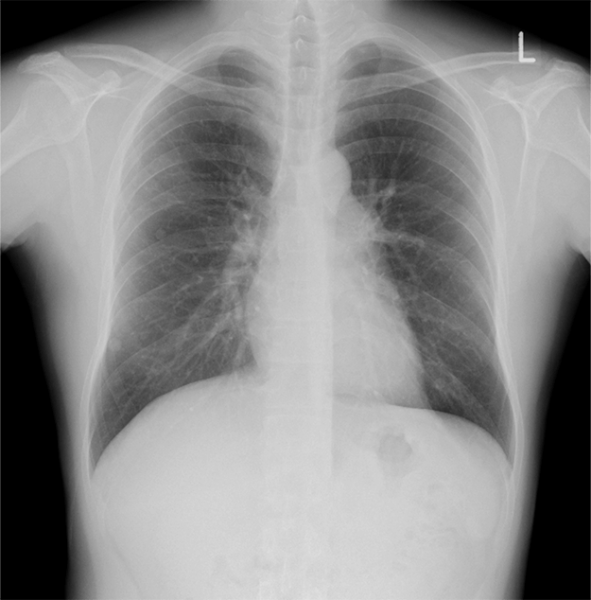 FDR Visionary Suite | Fujifilm Healthcare