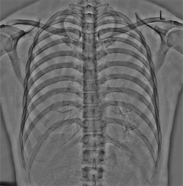 FDR Visionary Suite | Fujifilm Healthcare