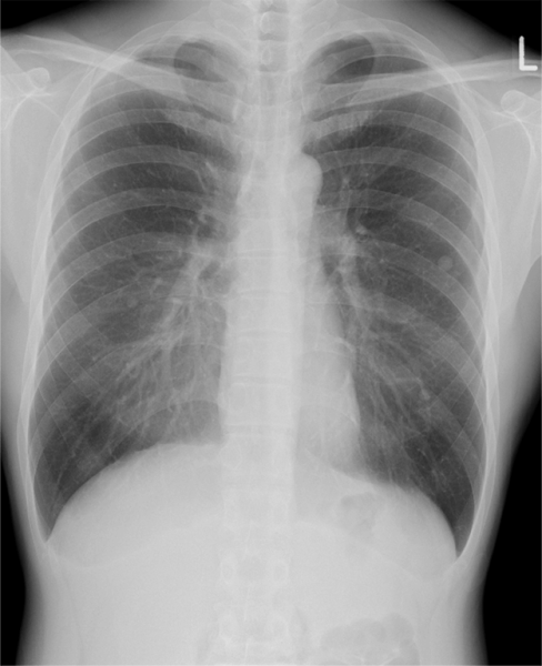 FDR Visionary Suite | Fujifilm Healthcare