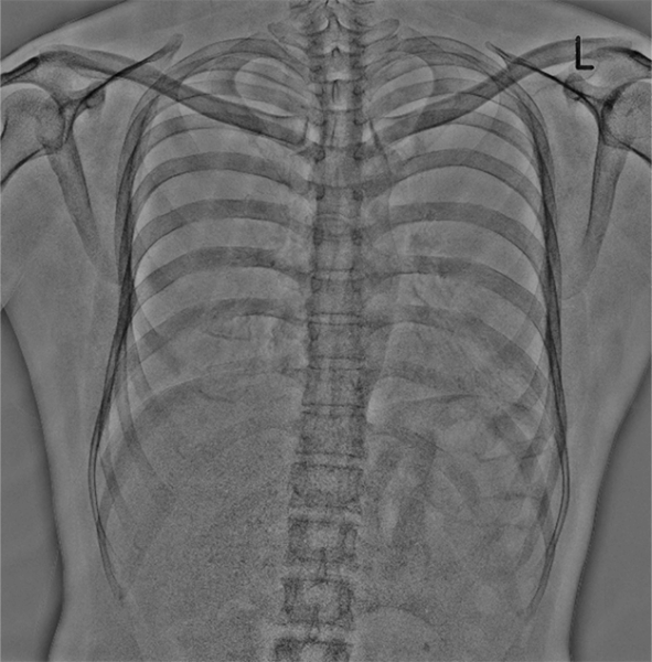 FDR Visionary Suite | Fujifilm Healthcare