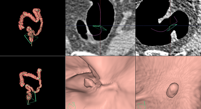 Gastroenterology | Fujifilm Healthcare