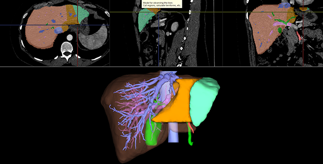 Gastroenterology | Fujifilm Healthcare