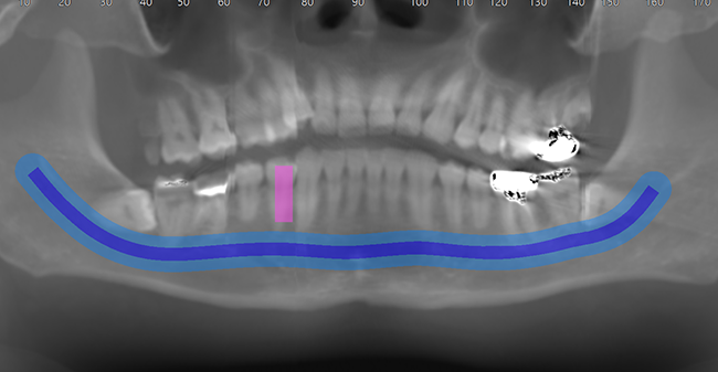 General Function | Fujifilm Healthcare