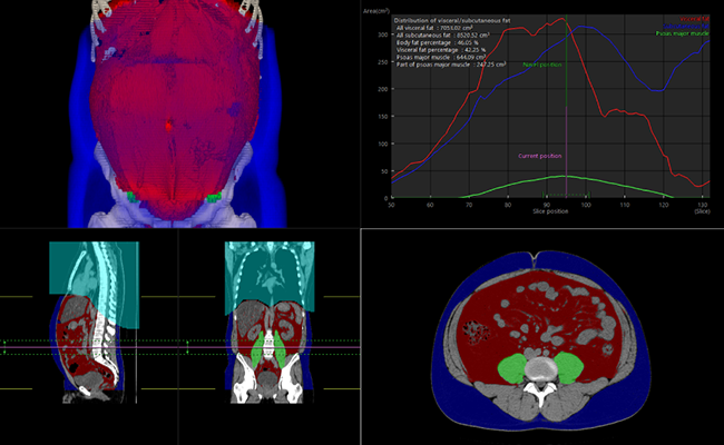 General Function | Fujifilm Healthcare