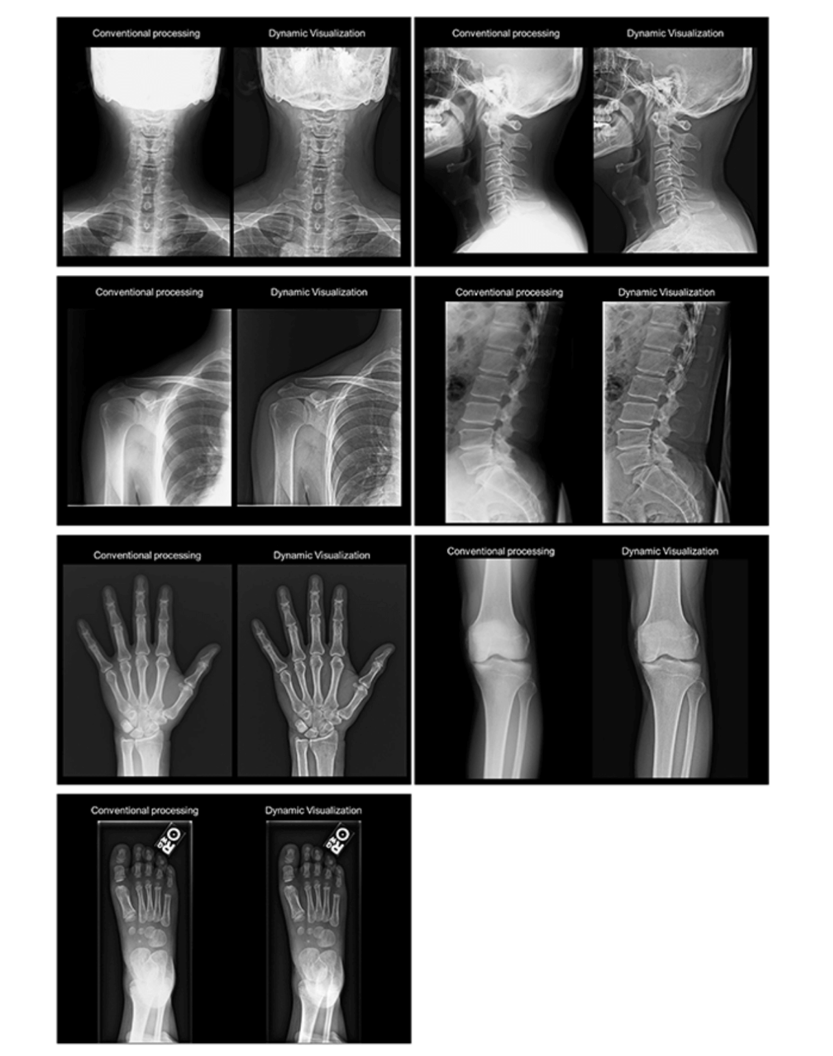 FDX Console | Fujifilm Healthcare