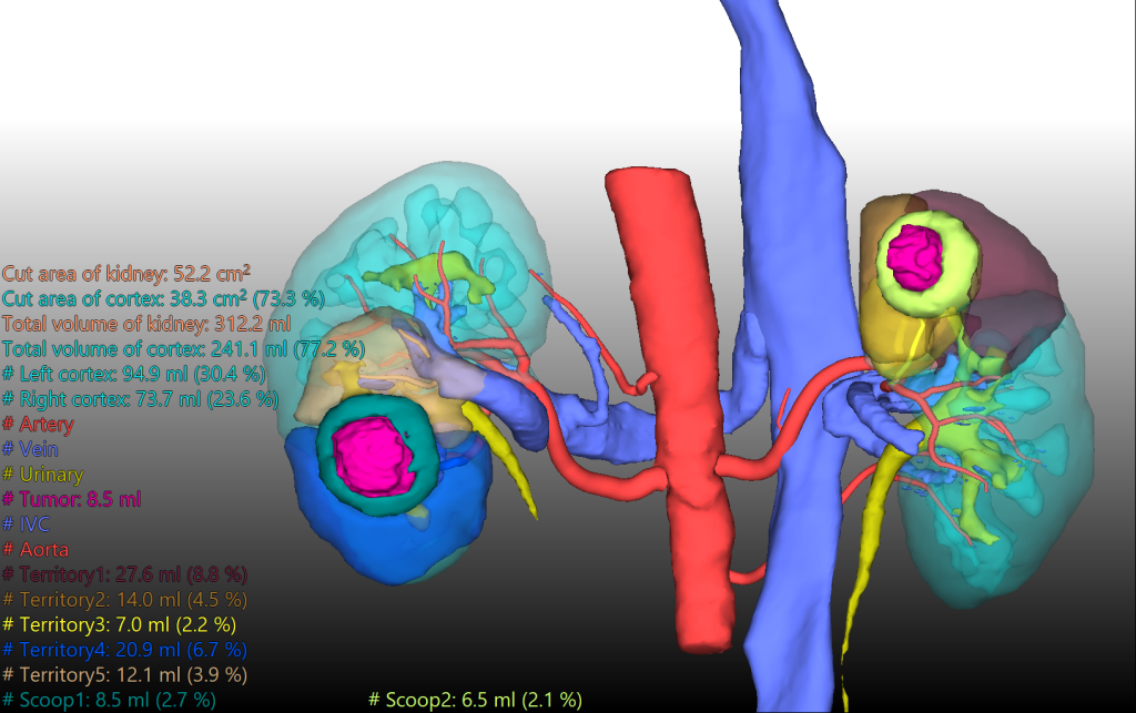 Urological Surgery | Fujifilm Healthcare