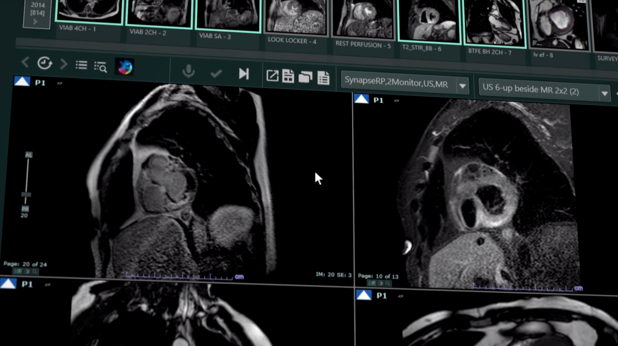 Medical Imaging Orchestrator with AI | Fujifilm Healthcare