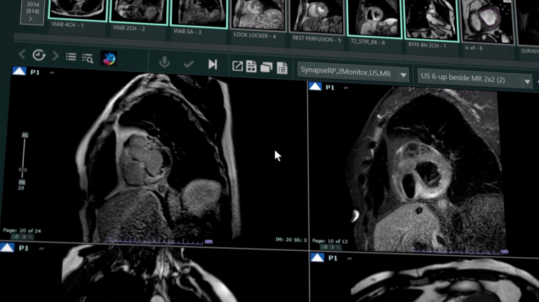 Medical Imaging Orchestrator with AI | Fujifilm Healthcare