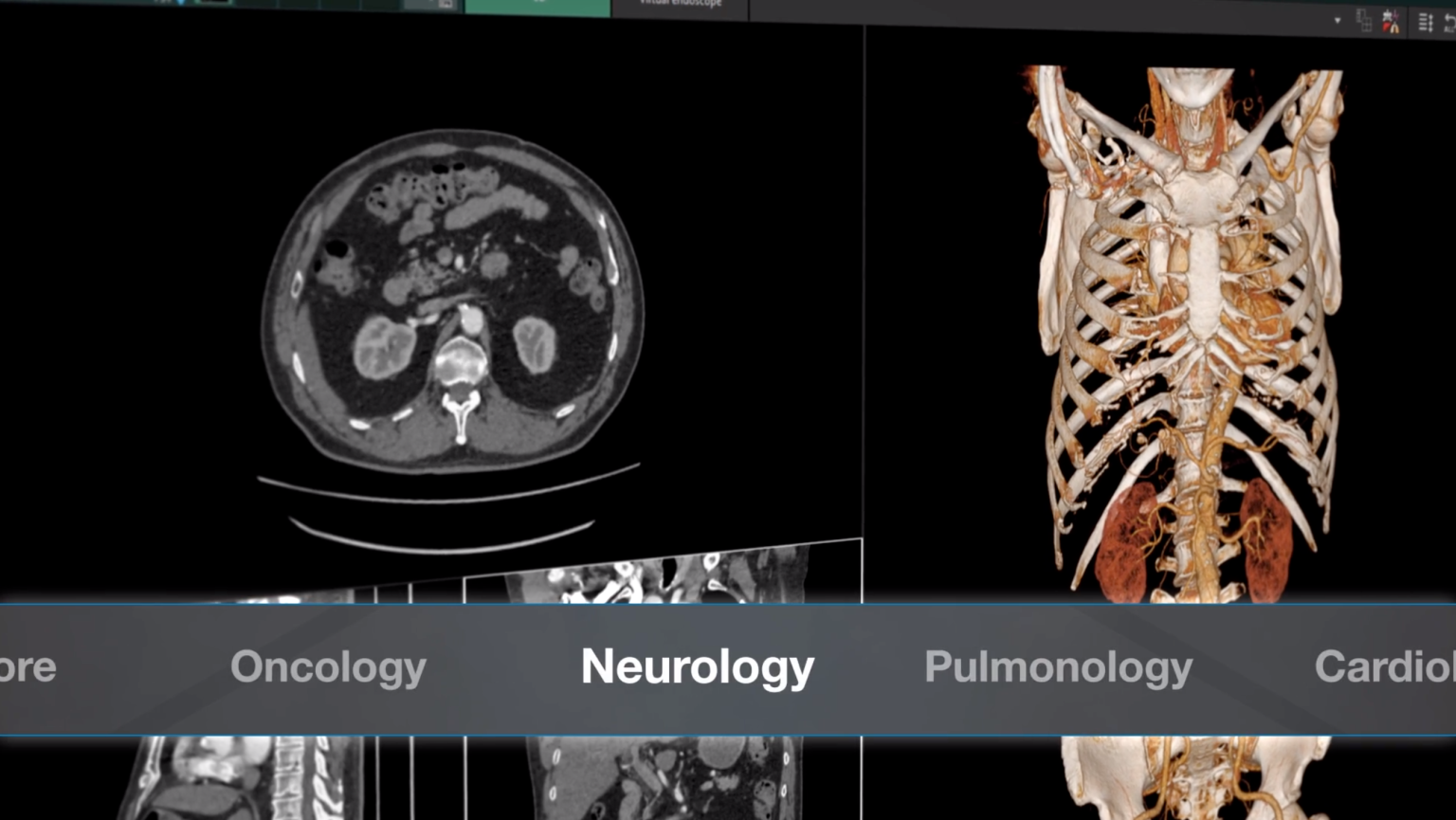 Synapse 3D Medical Imaging | Fujifilm Healthcare Solutions