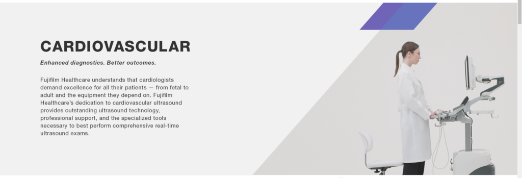 Cardiovascular Ultrasound – ARIETTA 65 | Fujifilm Healthcare