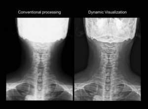 FDR AQRO | Fujifilm Healthcare