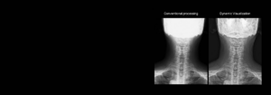 Dynamic Visualization™ | Fujifilm Healthcare