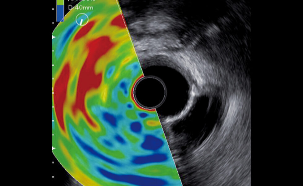 Diagnostic EUS Processors | Fujifilm Healthcare Solutions
