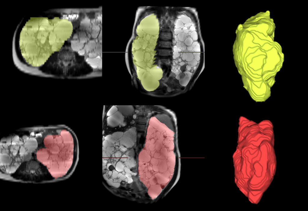 Urology | Fujifilm Healthcare