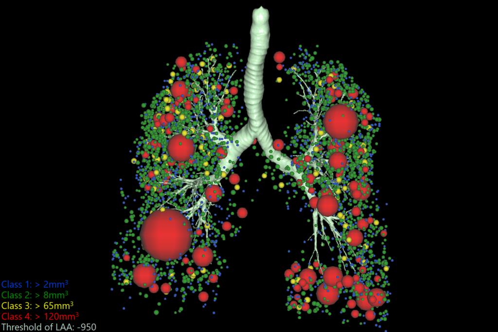 3D Pulmonology | Fujifilm Healthcare