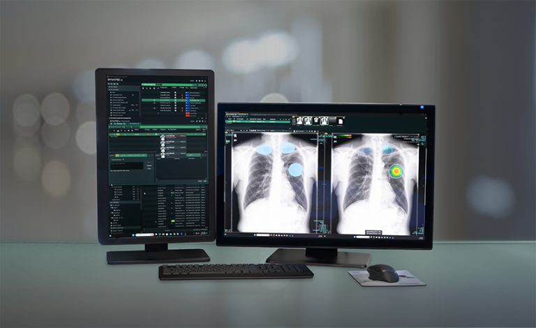 Radiology PACS System | Image Quality by Fujifilm Healthcare