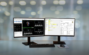 Cardiovascular Information Systems | Fujifilm Healthcare