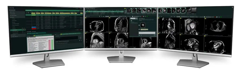 Three PACS Features That Can Help Alleviate Radiologic Technologist ...