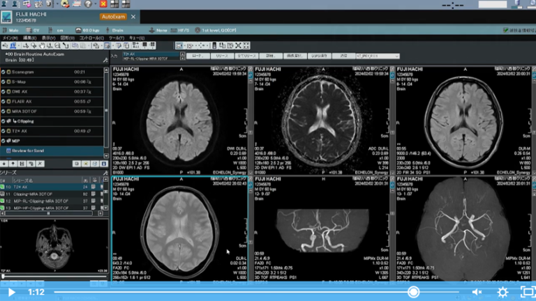 Echelon Synergy - FUJIFILM Healthcare Americas Corporation